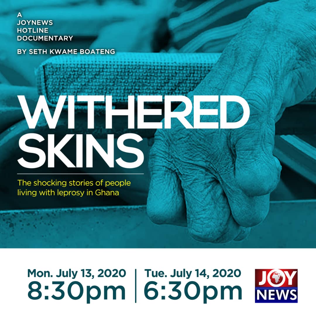 JoyNews’ Hotline documentary, ‘withered skins’ airs today - MyJoyOnline