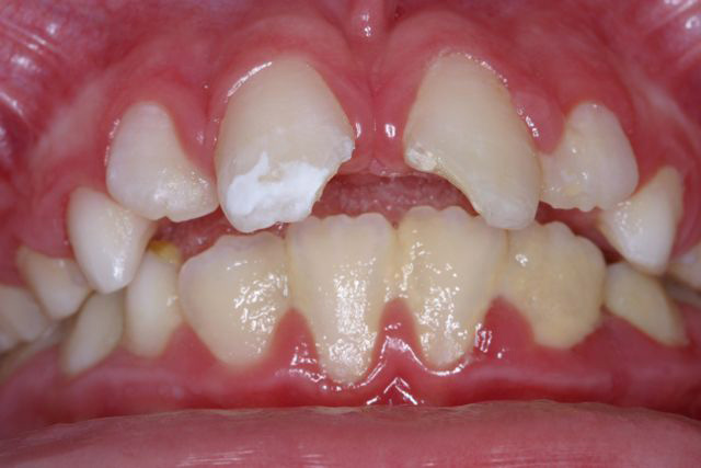 Dental trauma: What to know and what to do - MyJoyOnline