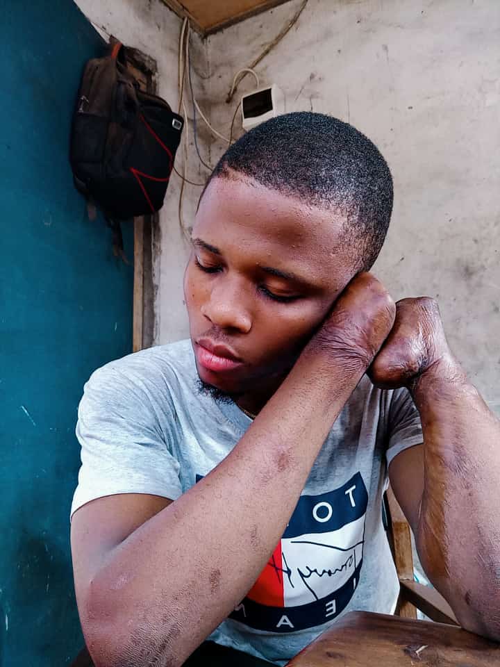 Disabled but uniquely abled; the intriguing story of Mohammed Issaka ...