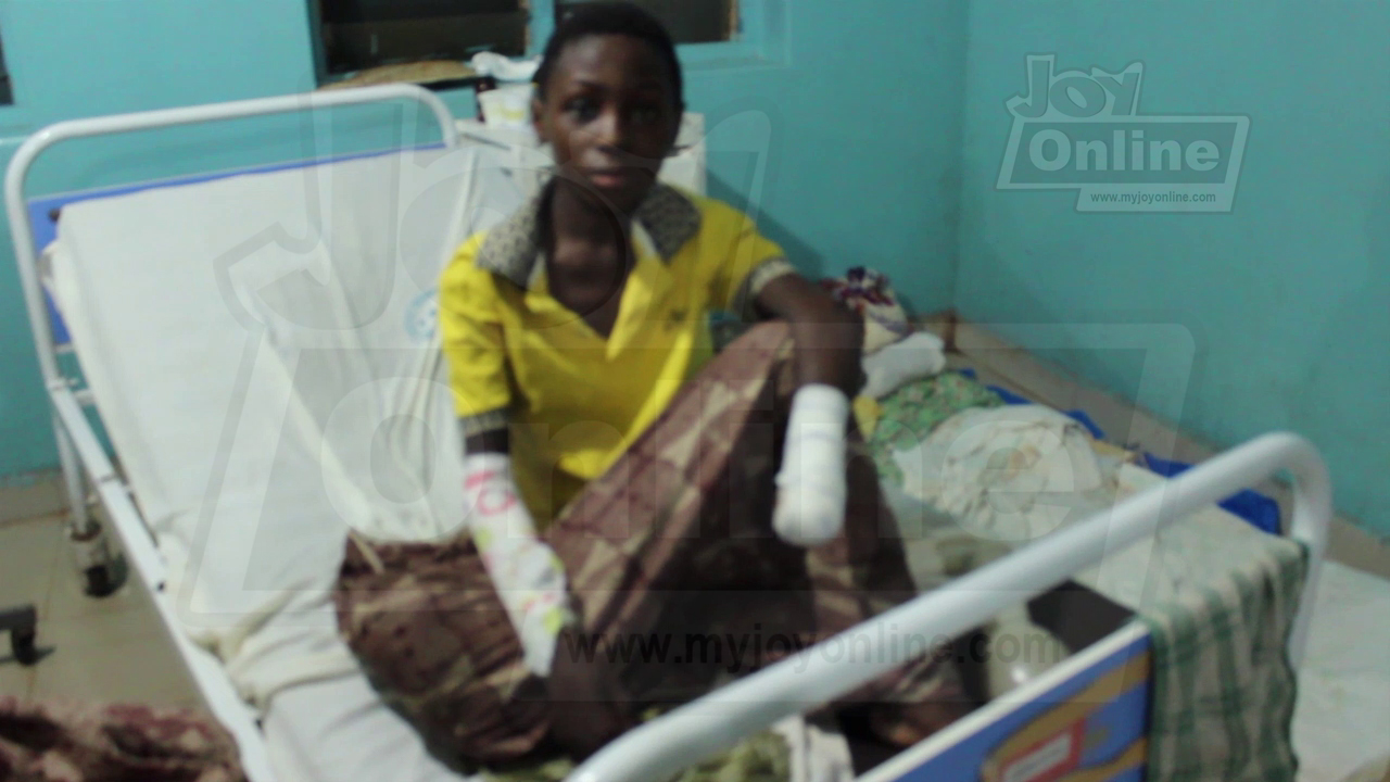 Police arrest 3 in connection with acid attack on limbs of 14-year-old ...