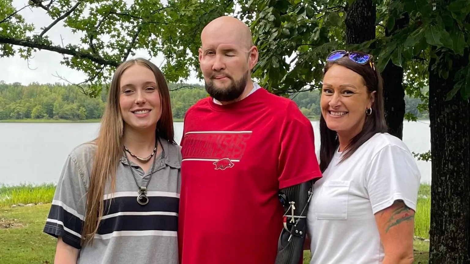 US veteran makes 'incredible' progress after world's first eye ...